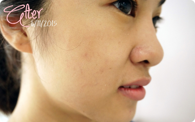 SNOWZ by seoul secret Glutathione plus Kiwi Seed Extract