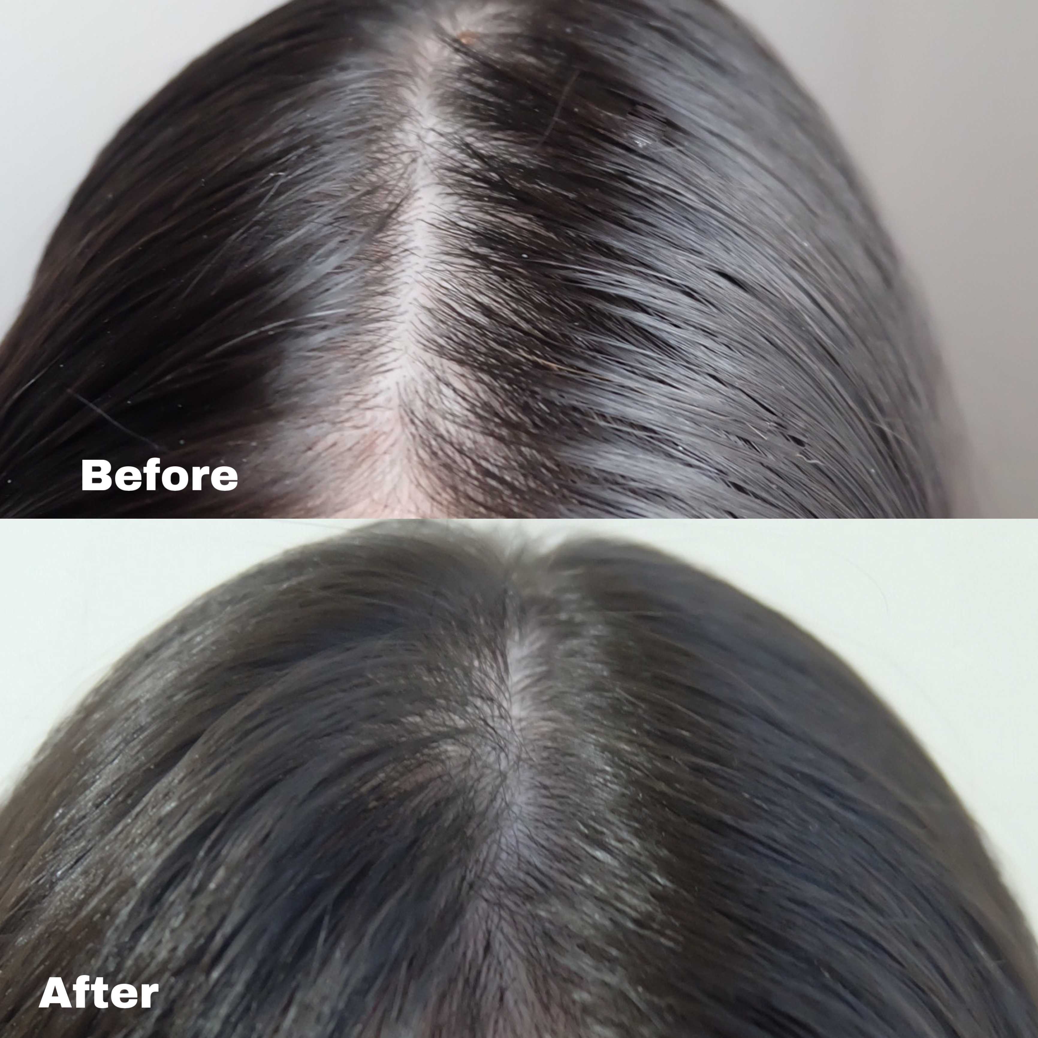 รีวิว Clear Scalpceuticals Shampoo Hair Fall Resist