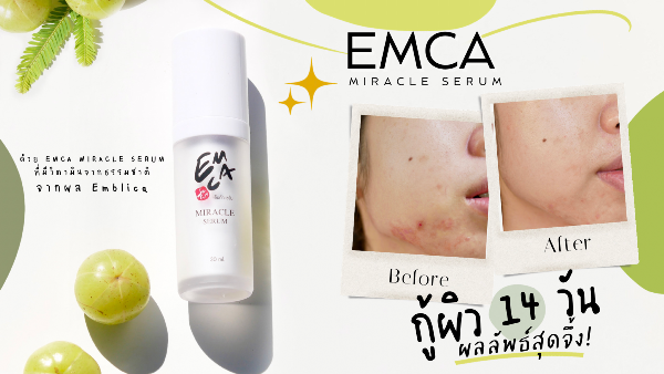 ผลลัพธ์สุดจึ้ง! กู้ผิว 14 วัน กับ EMCA Miracle Serum ด้วย Emblica