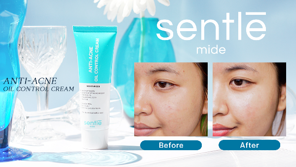 มอยเจอร์ไรเซอร์สำหรับหน้ามันลดสิว sentle mide anti-acne oil control ...