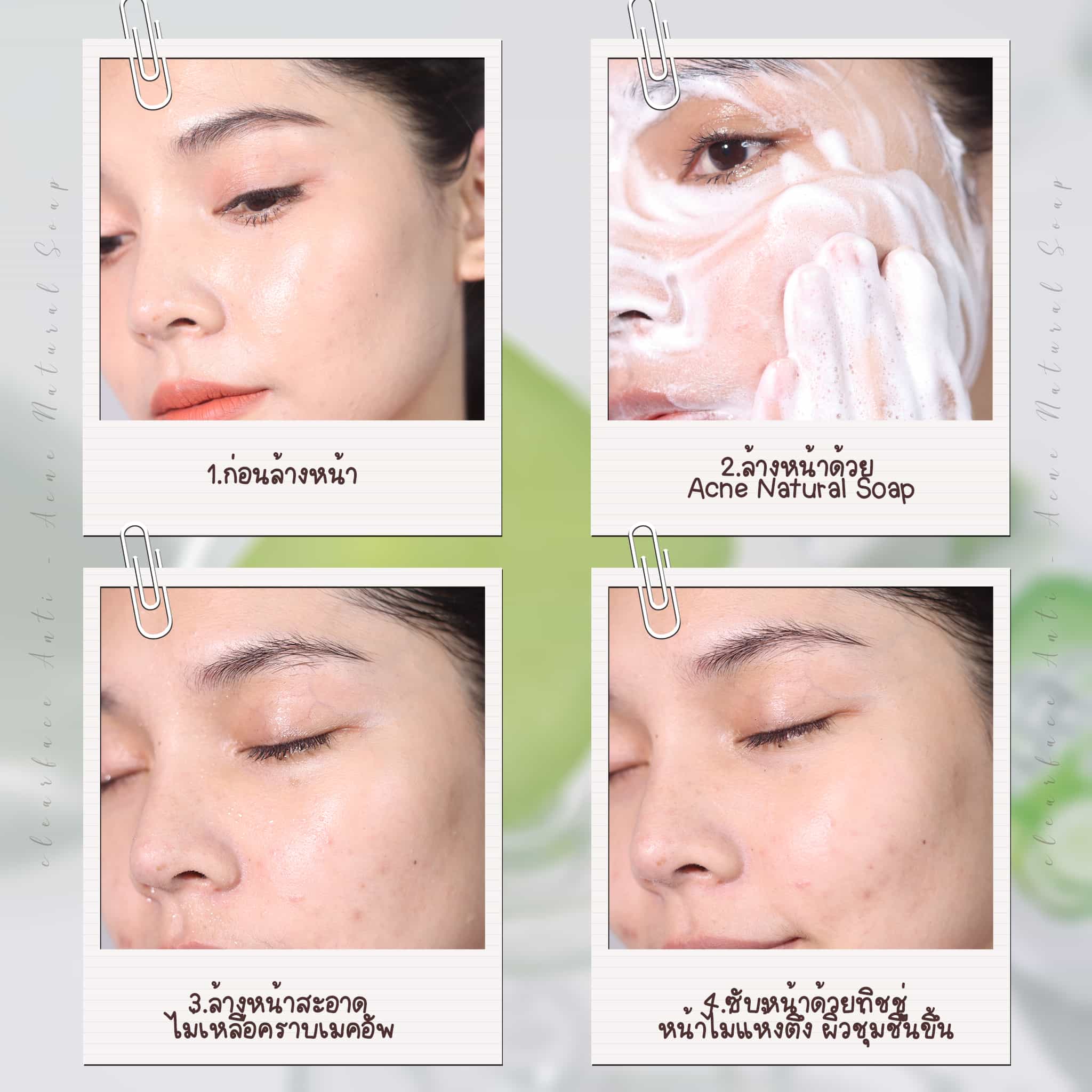 จัดการสิว รอยสิวใน 7 วัน หลักสิบผิวก็ดีขึ้นได้นะ | clearface