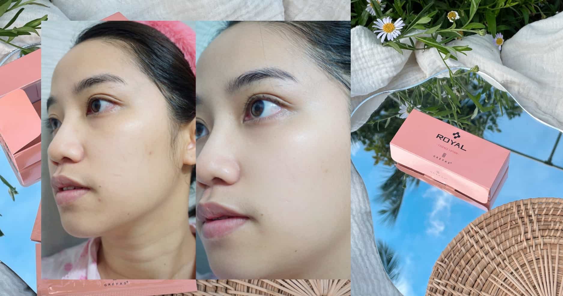 มา Anti - Aging ด้วย Placenta จาก GREFAS Royal Essence Lotion