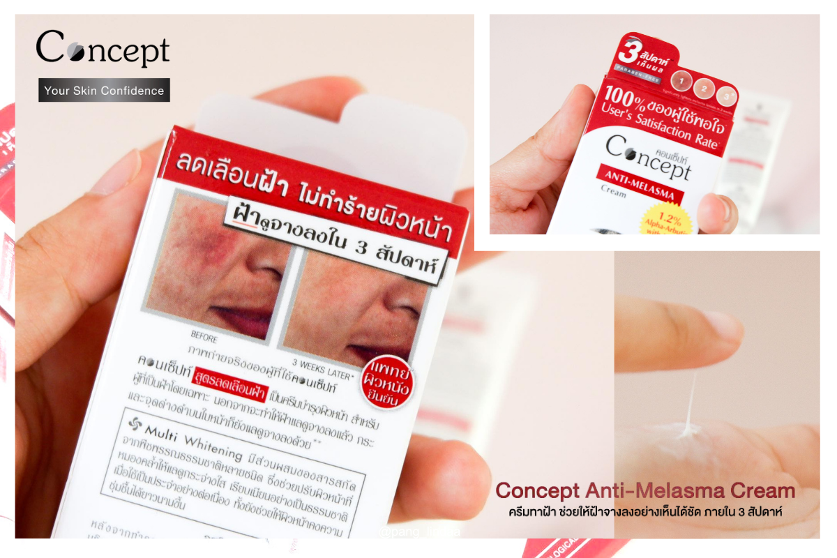 Review Concept Anti-Melasma Cream I สาย ฝอ อา ฝาไม้โท ฝ้า ต้องลอง!